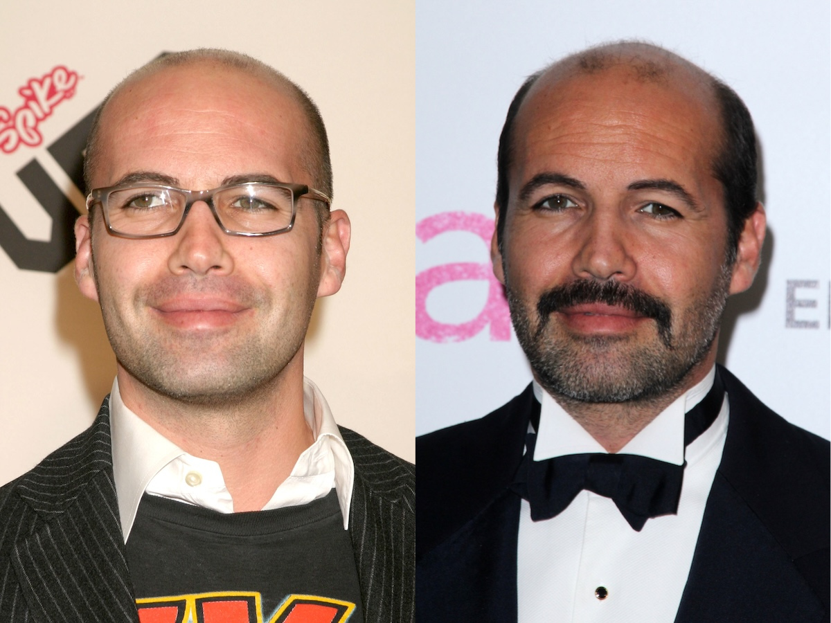 Stages Of Male Pattern Baldness: The Norwood Scale | DrHair