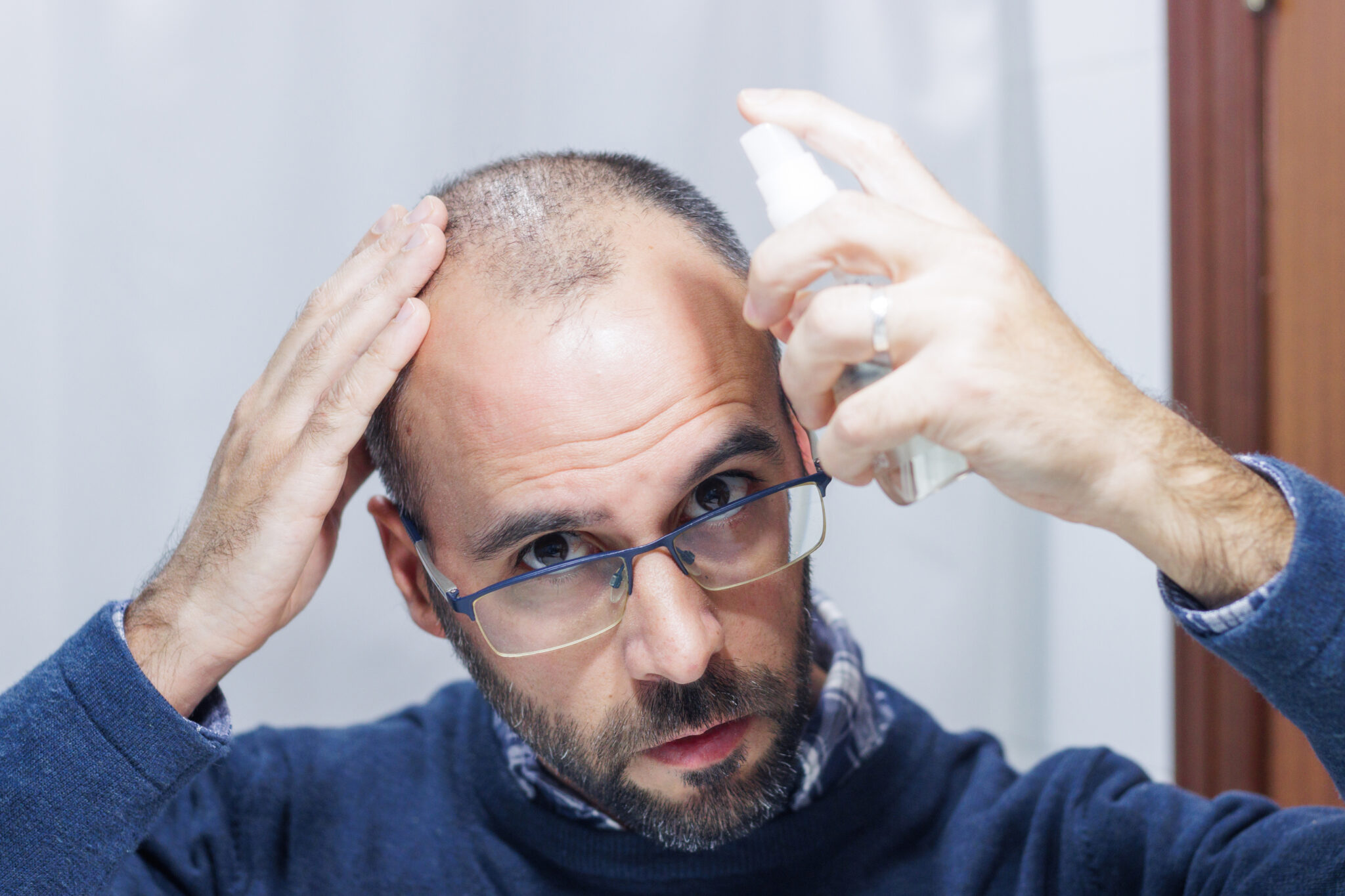 Does Finasteride Affect Fertility?